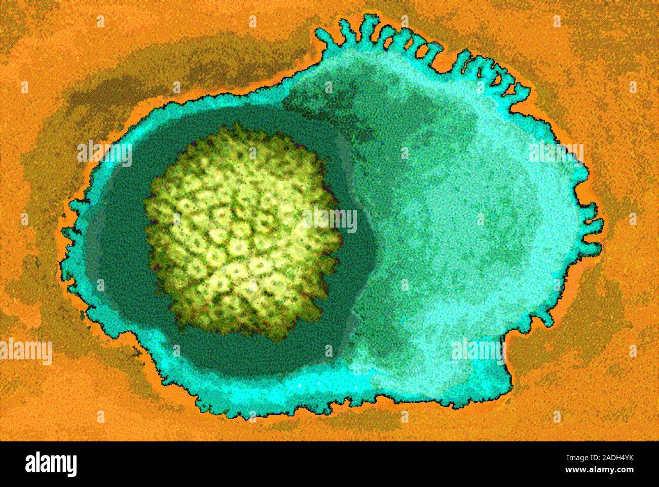 Herpes simplex virus. Coloured transmission electron micrograph (TEM ... Herpes simplex virus. Coloured transmission electron micrograph (TEM ...