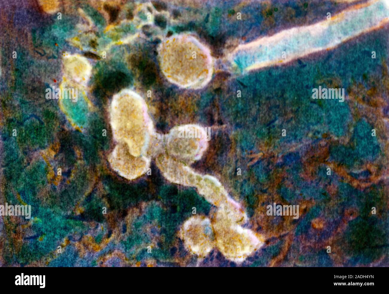 AIDS viruses on T-cell. Coloured scanning electron micrograph (SEM) of ...