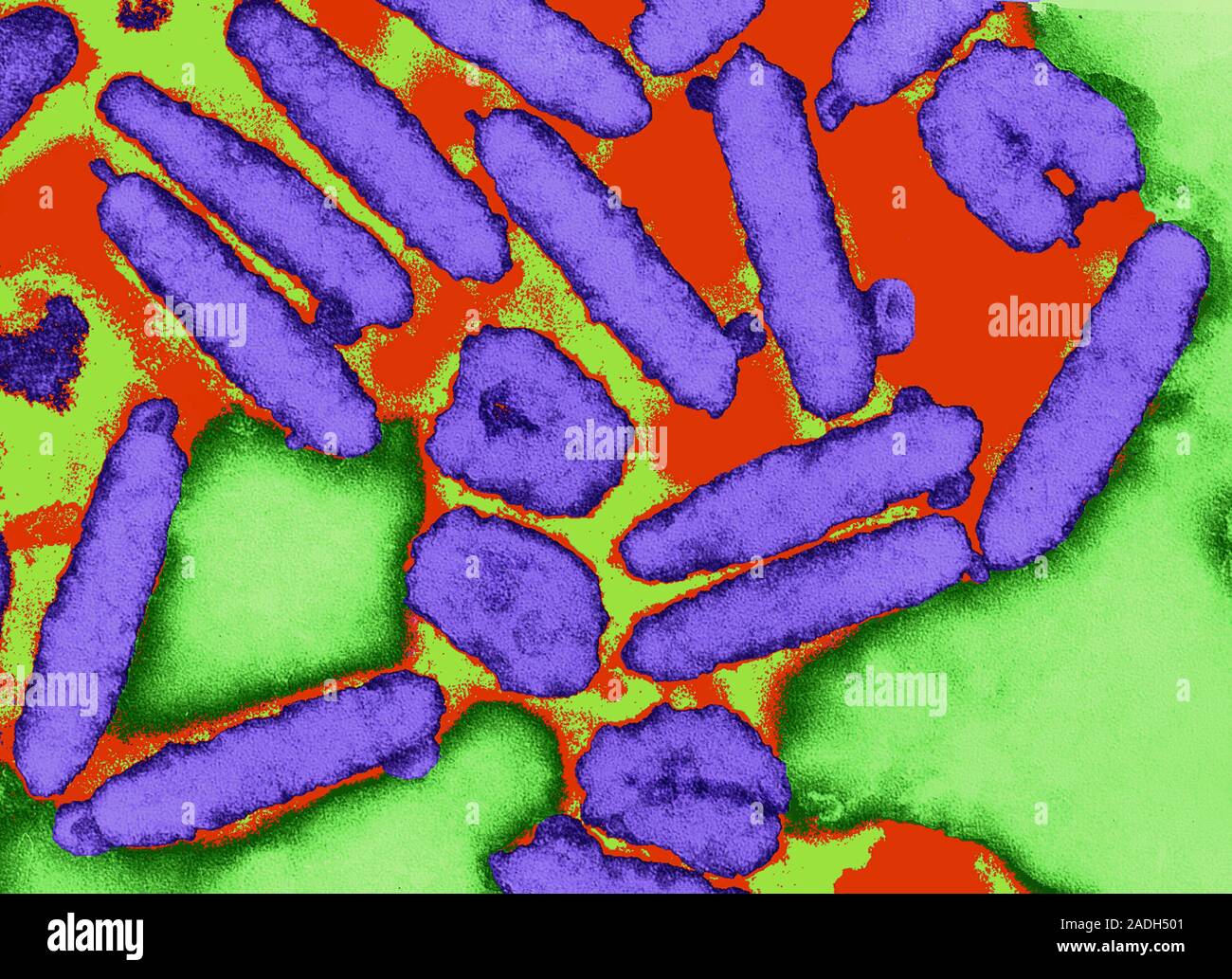 Nuclear polyhedrosis viruses. Coloured transmiss- ion electron ...