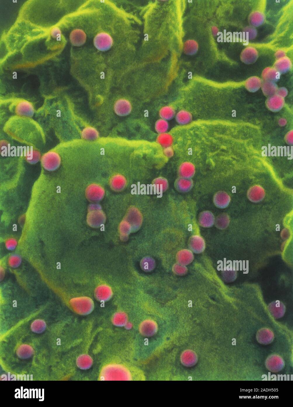 AIDS viruses. Coloured scanning electron micrograph (SEM) of the ...