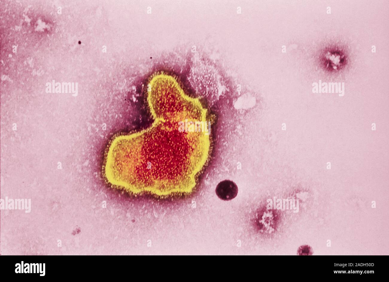 Respiratory syncytial virus. Coloured transmission electron micrograph ...