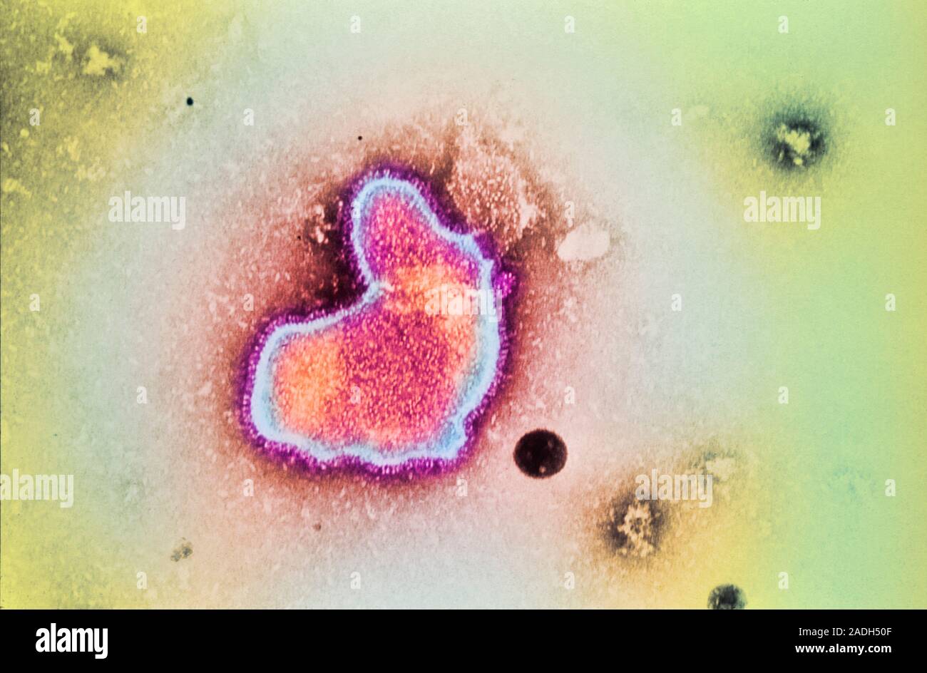 Respiratory syncytial virus. Coloured transmission electron micrograph ...