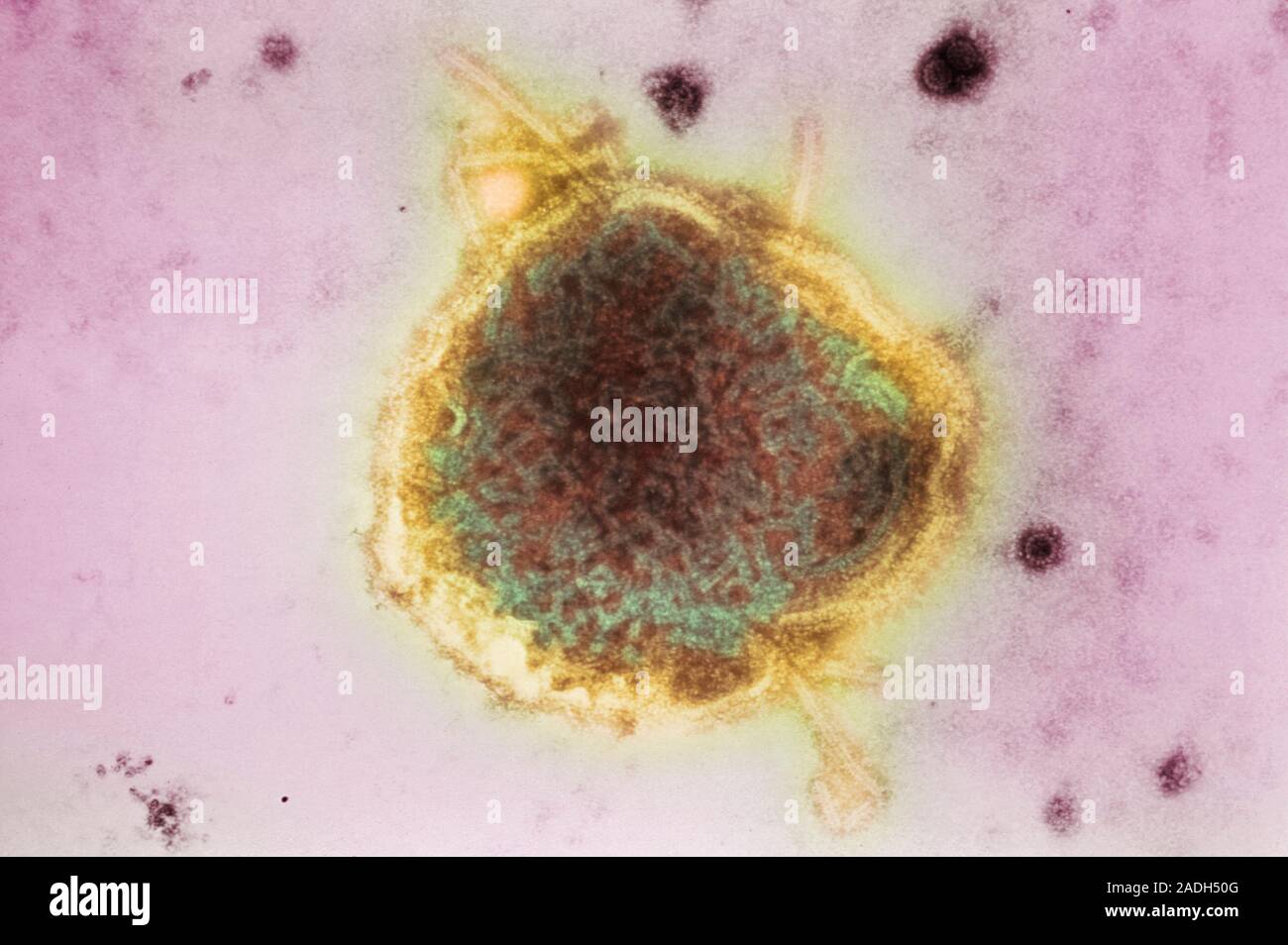 Measles virus. Coloured transmission electron micrograph (TEM) of a ... Measles virus. Coloured transmission electron micrograph (TEM) of a ...