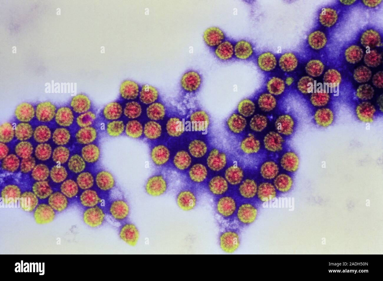 Polyoma viruses. Coloured transmission electron micrograph (TEM) of ...