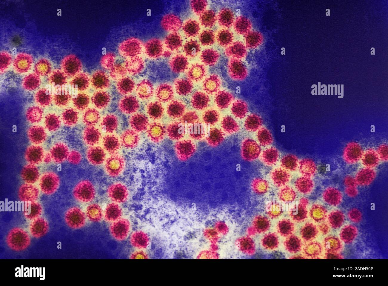 Caliciviruses. Coloured transmission electron micrograph (TEM) of ...