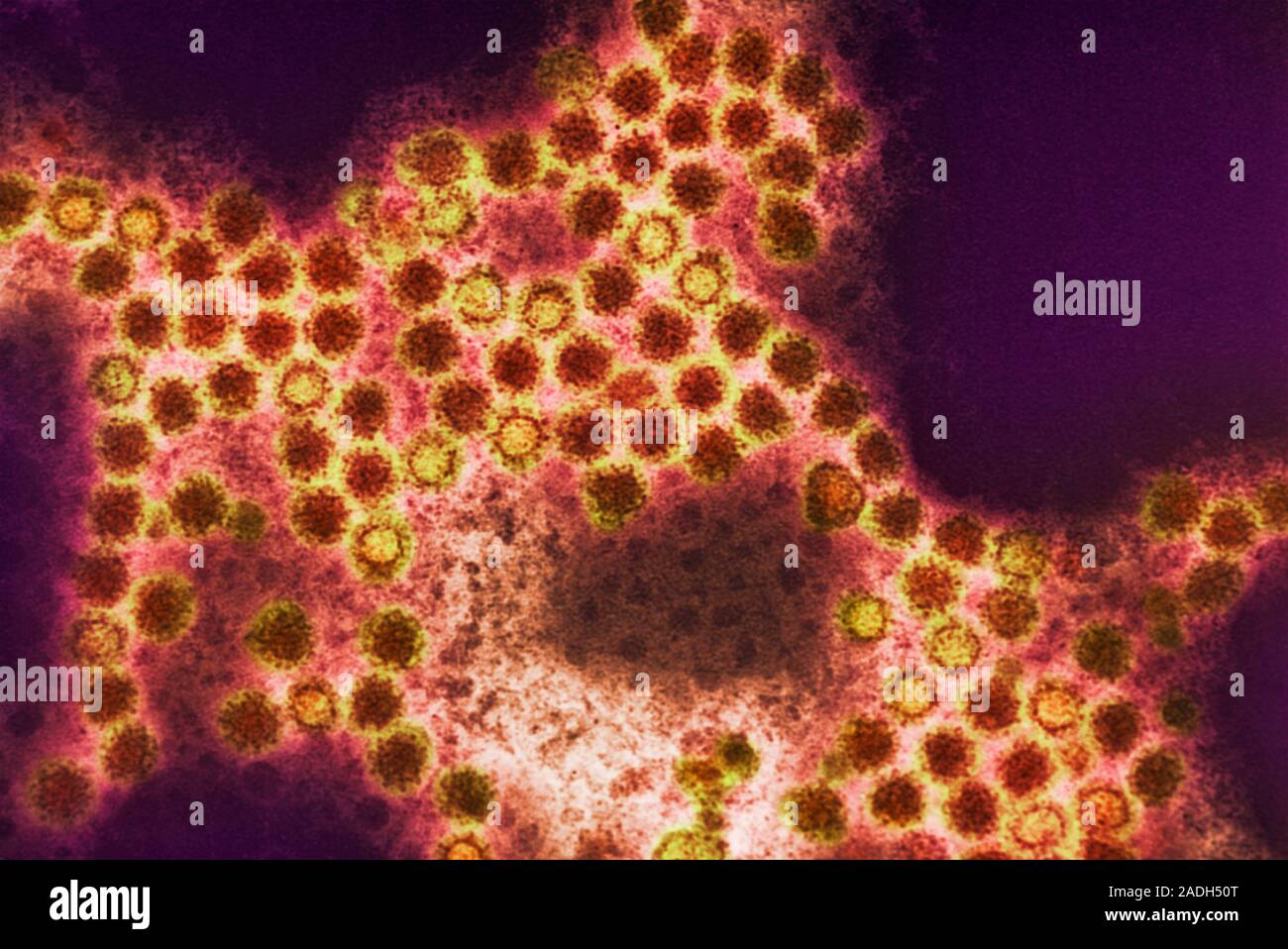 Caliciviruses. Coloured transmission electron micrograph (TEM) of ...
