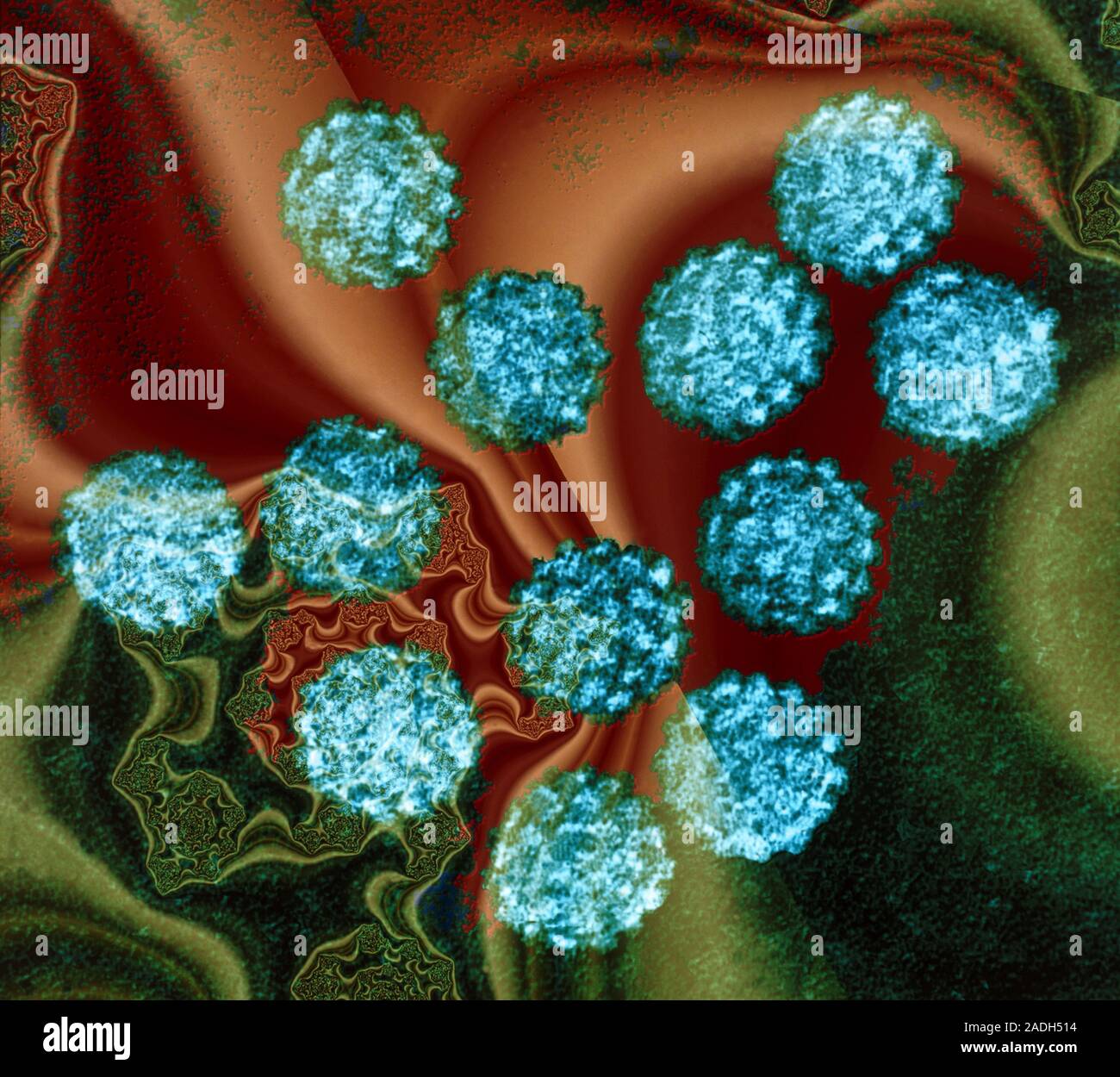 Papilloma viruses. Coloured transmission electron micrograph (TEM) of ...