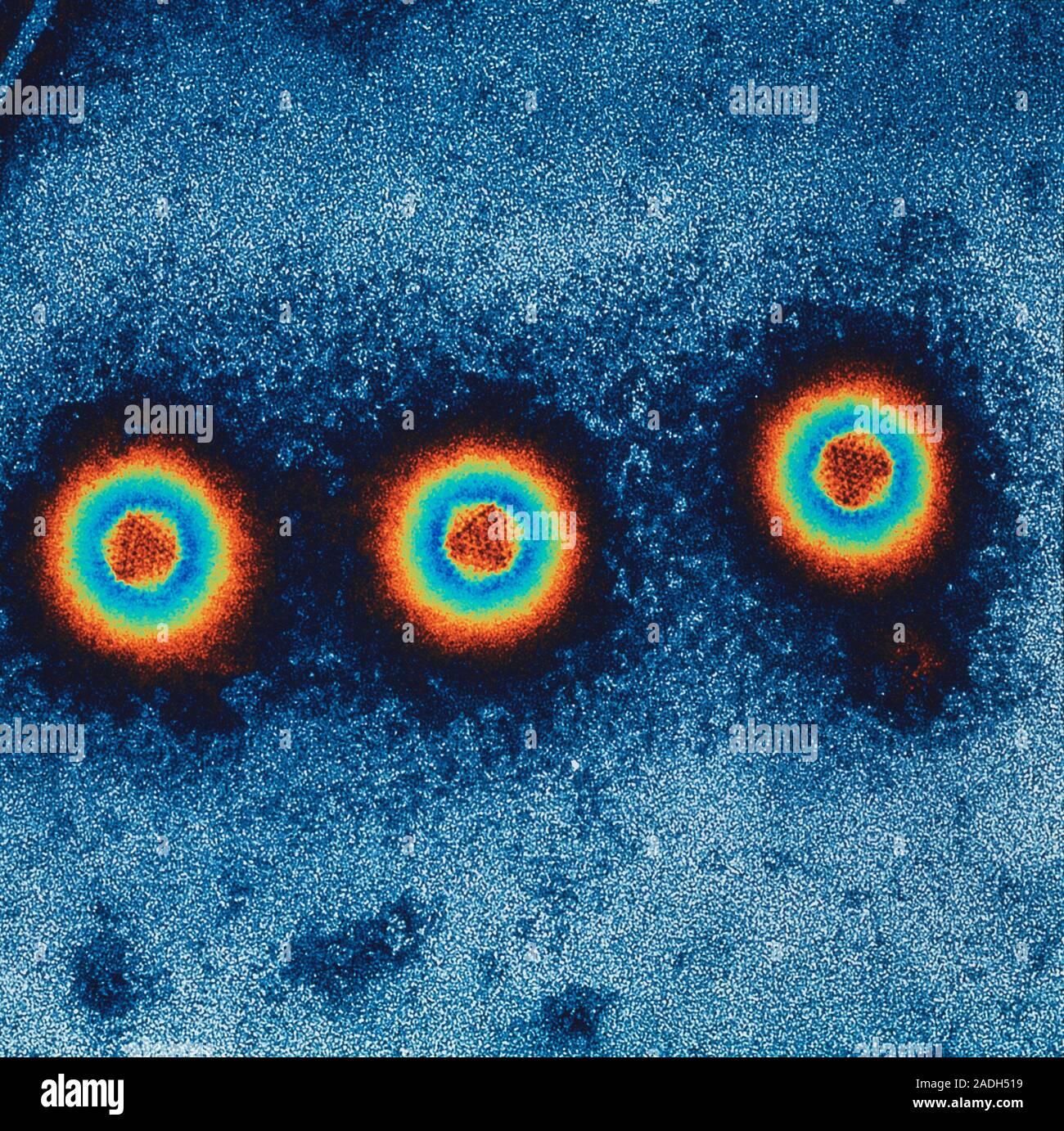 Adenoviruses. Coloured transmission electron micrograph (TEM) of three ...