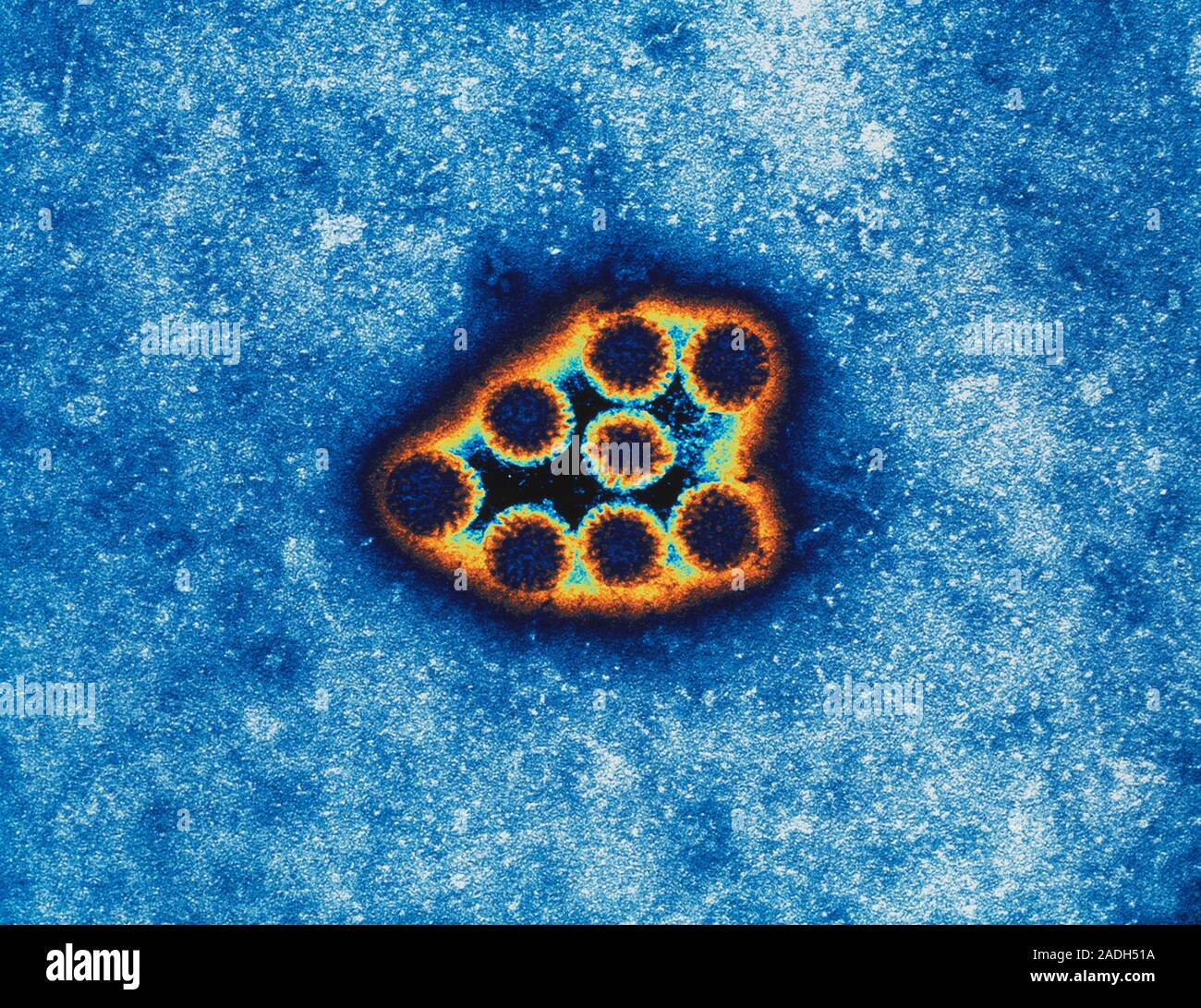 Rotaviruses. Coloured transmission electron micrograph (TEM) of ...