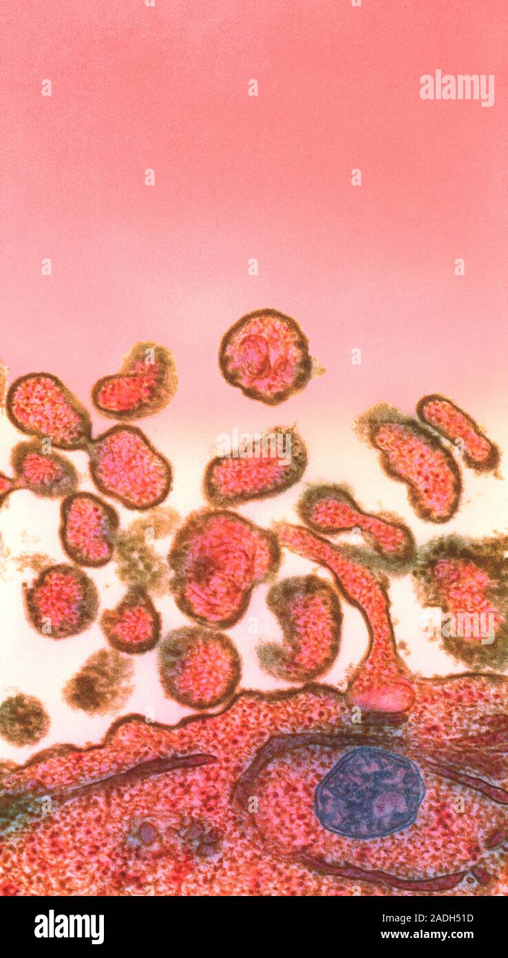 Measles virus. Coloured transmission electron micrograph (TEM) of ...