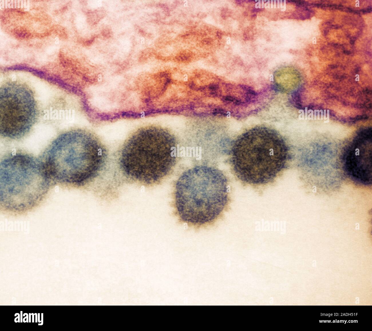 Crimean-Congo haemorrhagic fever viruses. Coloured transmission ...