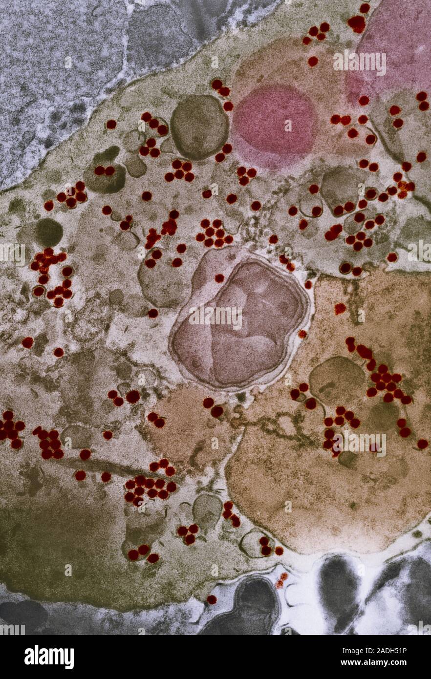 Yellow fever virus particles. Coloured transmission electron micrograph ...