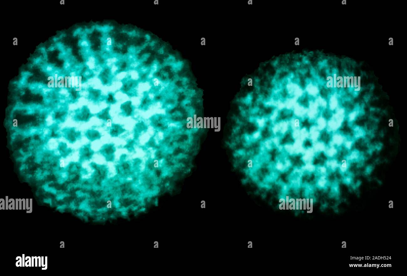 Rotaviruses. Coloured transmission electron micrograph (TEM) of two ...