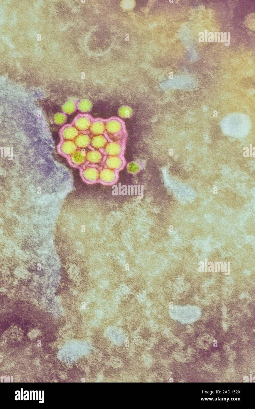 Yellow fever virus particles. Coloured transmission electron micrograph ...