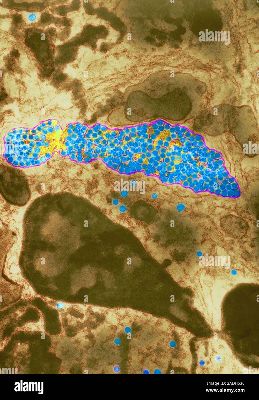 Dengue fever virus particles. Coloured transmission electron micrograph ...