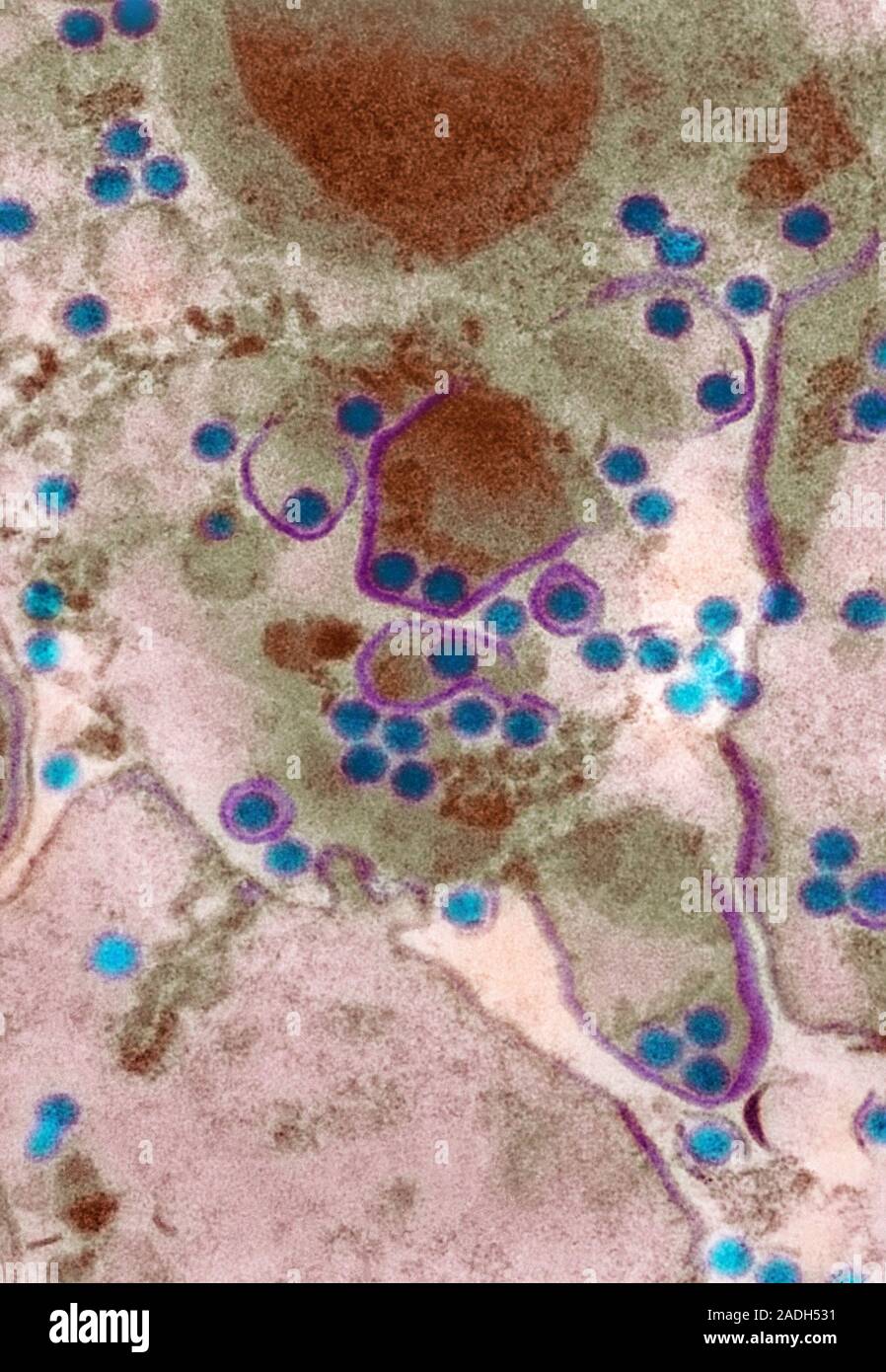 Dengue fever virus particles. Coloured transmission electron micrograph ...