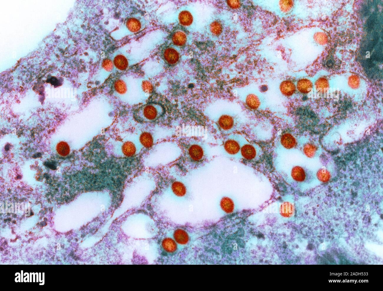 Rift Valley fever virus. Coloured transmission electron micrograph (TEM ...