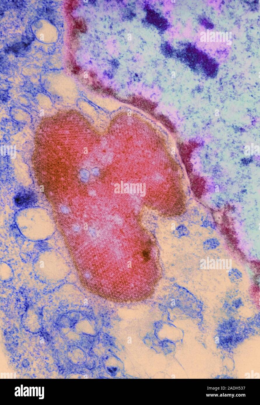 Dengue fever virus replication. Coloured transmission electron ...