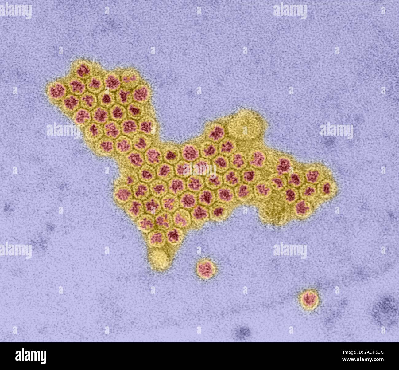 Polio virus. Coloured transmission electron micrograph (TEM) of a ...