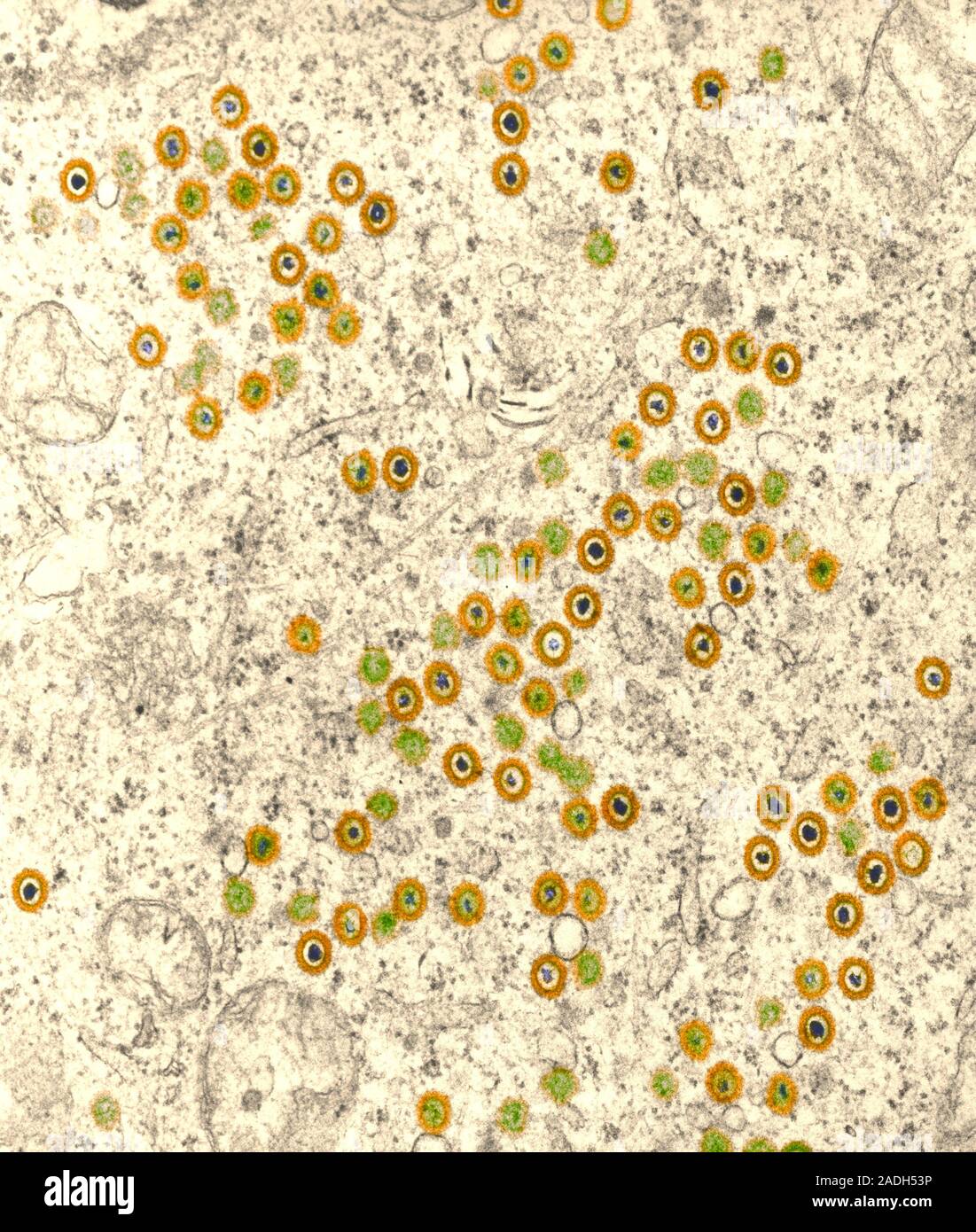 Herpes virus. Transmission electron micrograph (TEM) of human herpes ...