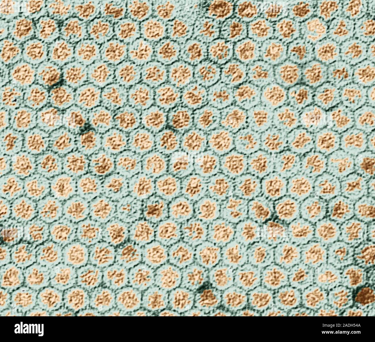 Polio virus. Coloured transmission electron micrograph (TEM) of a ...