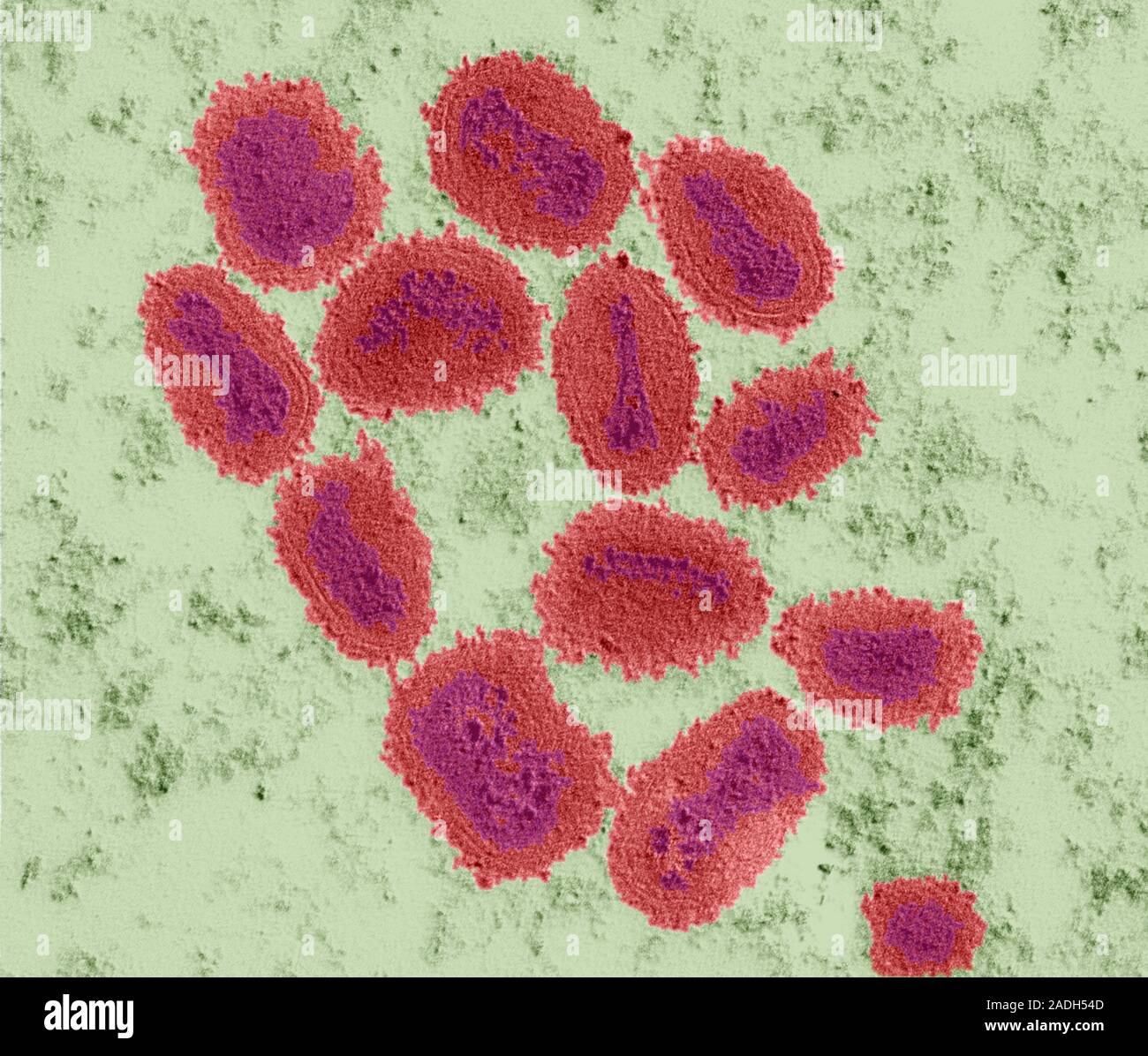 Vaccinia virus particles. Coloured transmission electron micrograph ...