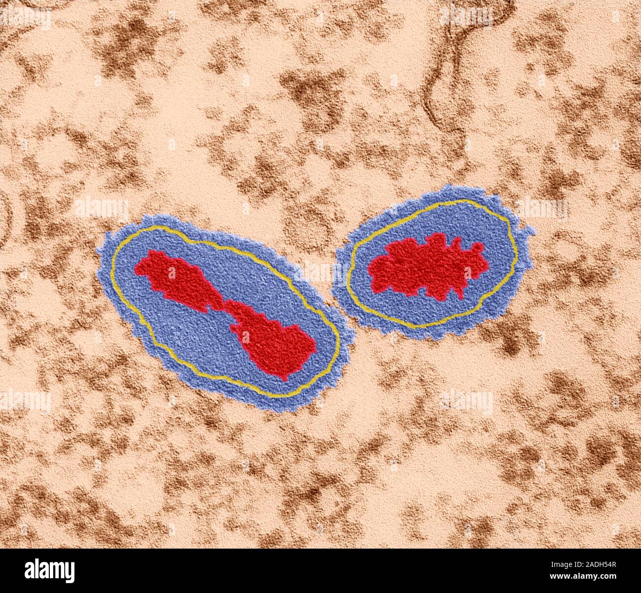 Vaccinia virus particles. Coloured transmission electron micrograph ...