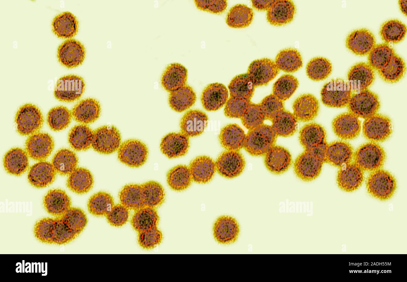 West Nile viruses. Coloured transmission electron micrograph (TEM) of ...