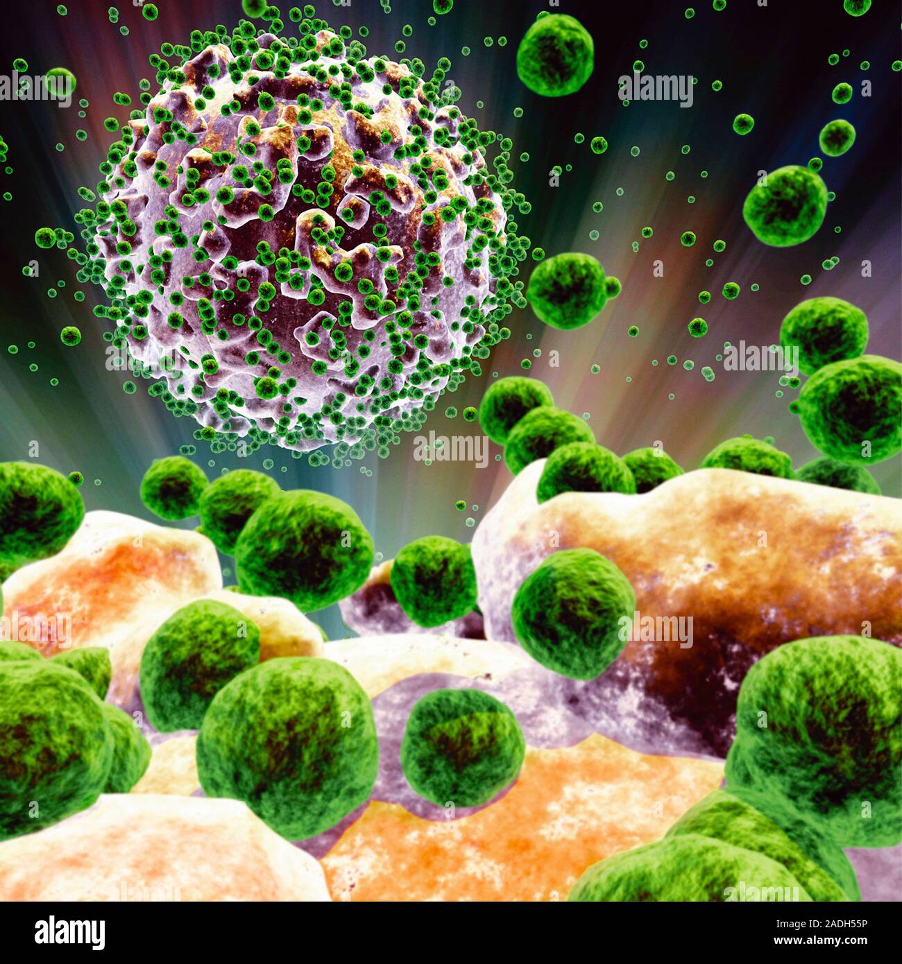 AIDS virus particles. Computer artwork of AIDS virus particles (virions ...