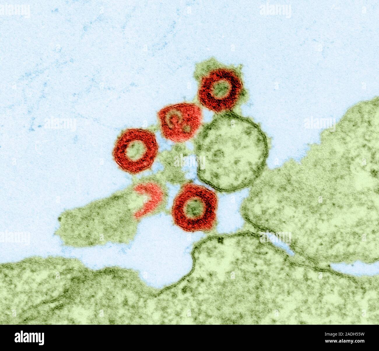 Human retrovirus. Coloured transmission electron micrograph (TEM) of ...