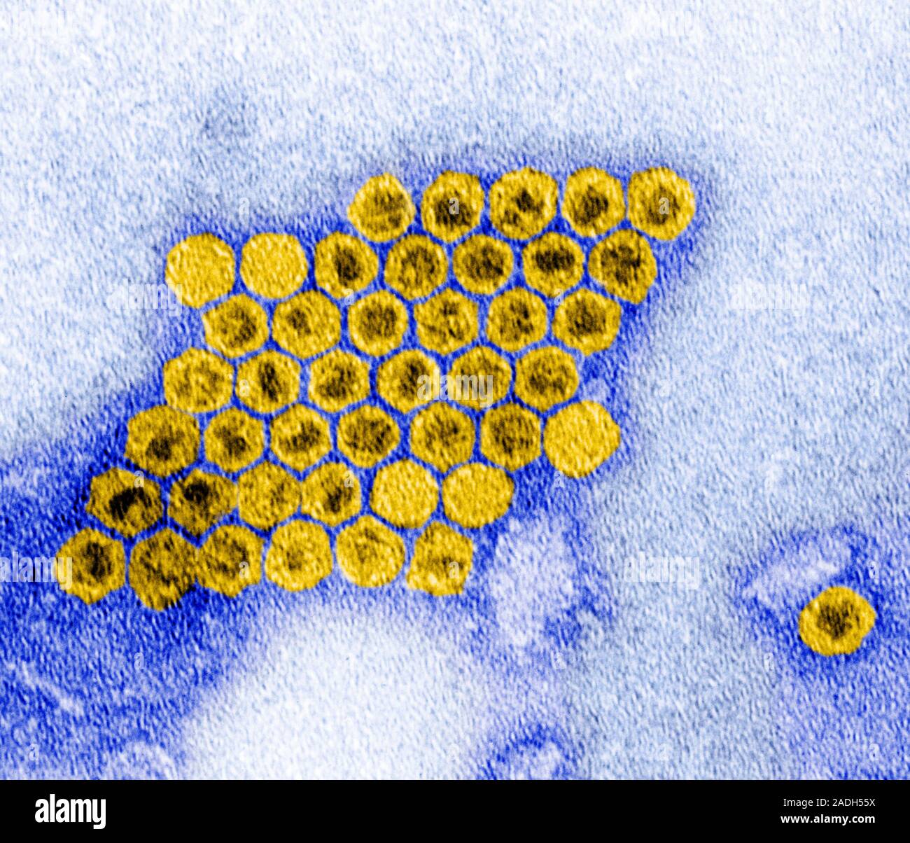 Polio virus. Coloured transmission electron micrograph (TEM) of a ...