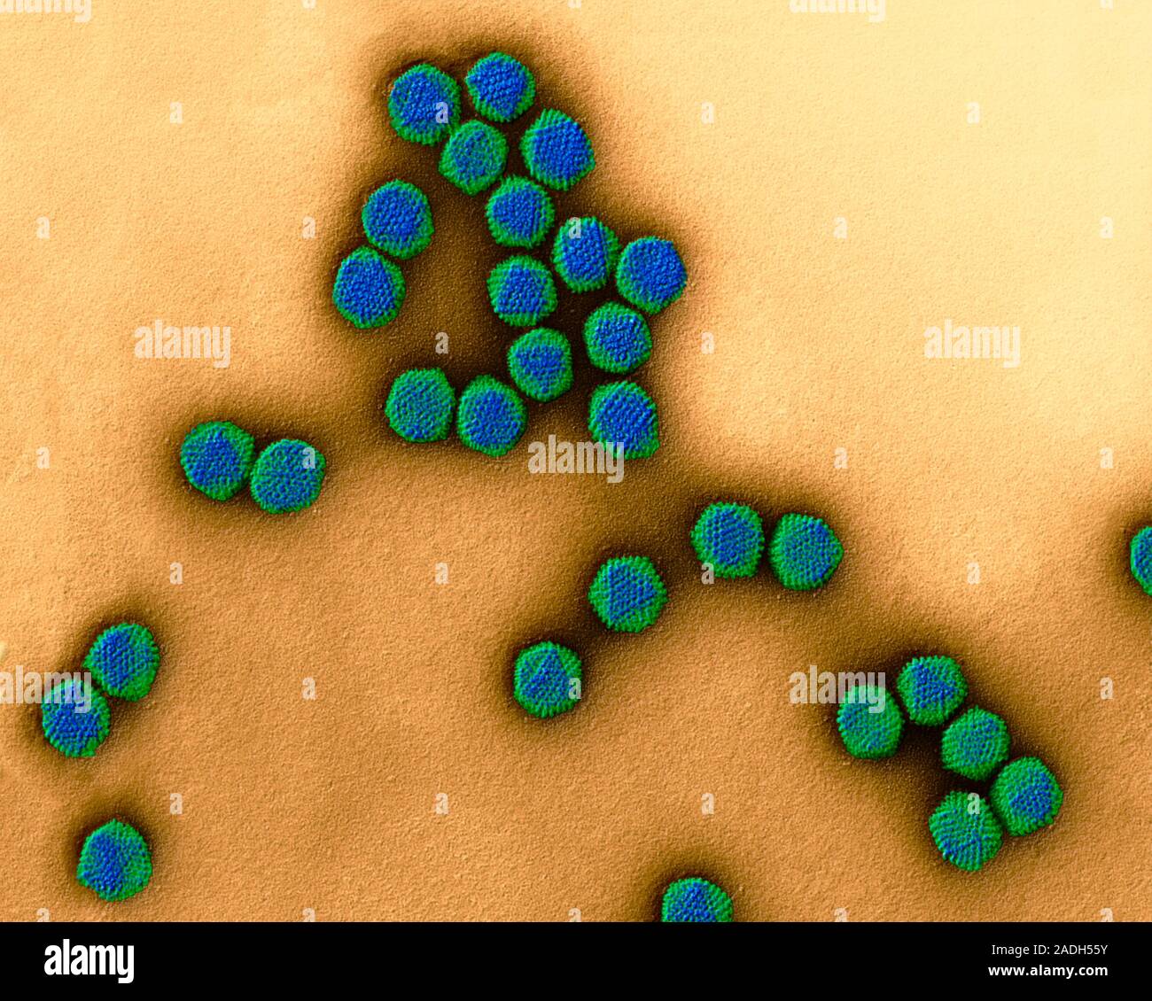 Adenoviruses. Coloured transmission electron micrograph (TEM) of ...