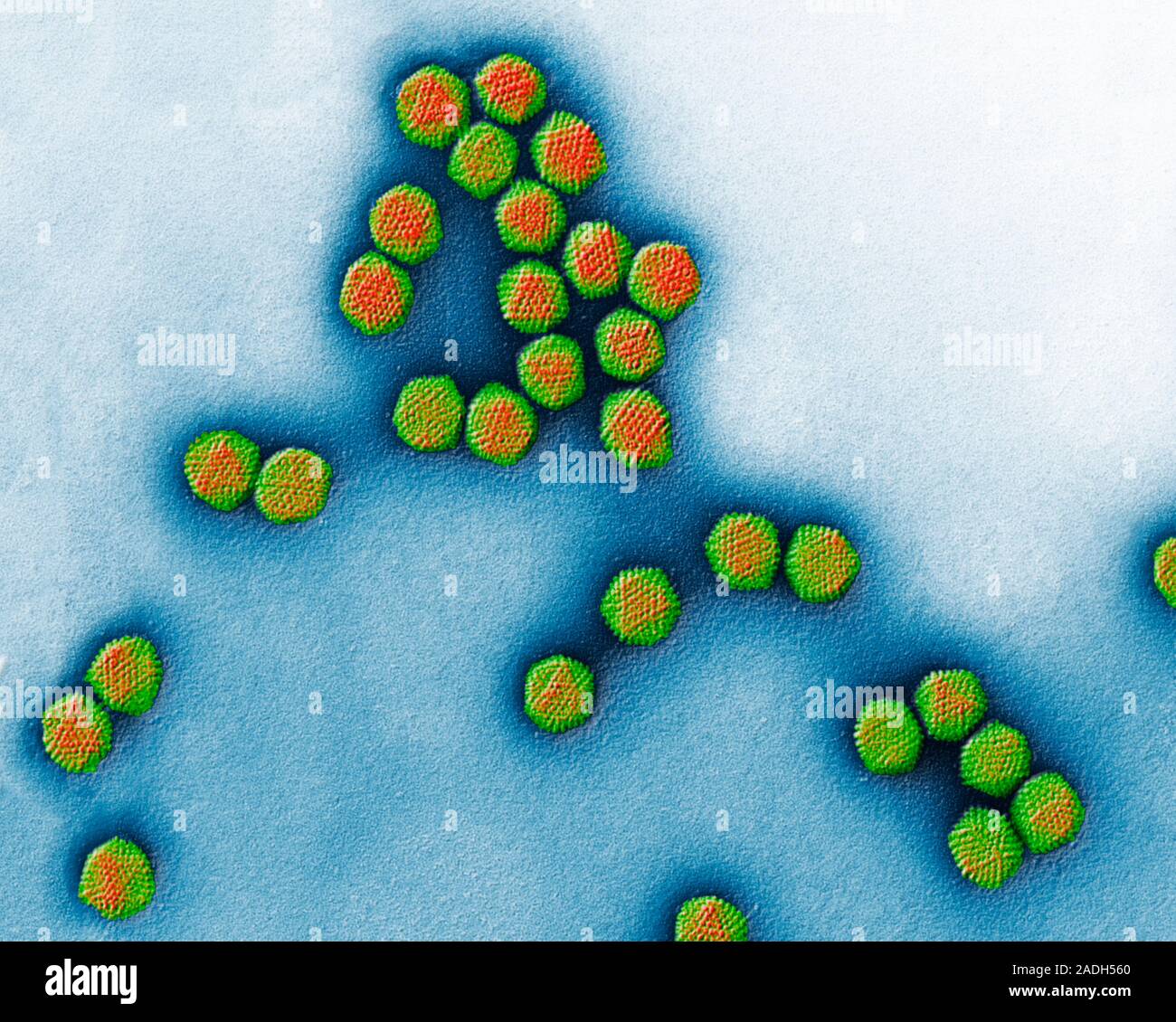 Adenoviruses. Coloured transmission electron micrograph (TEM) of ...