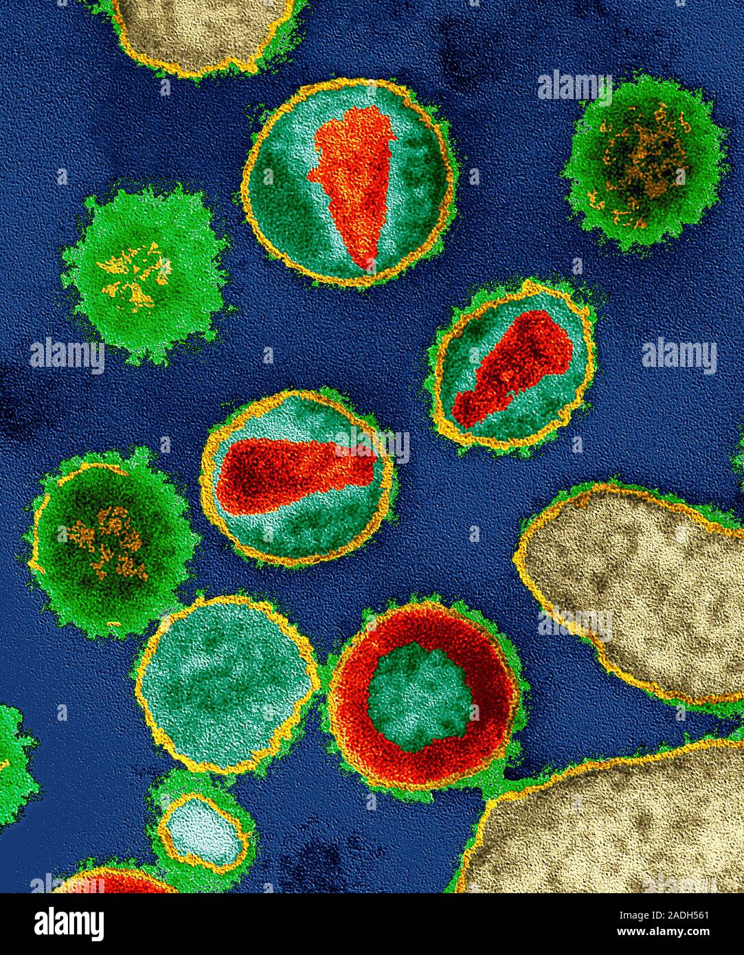 HIV. Coloured transmission electron micrograph (TEM) of HIV (human ...
