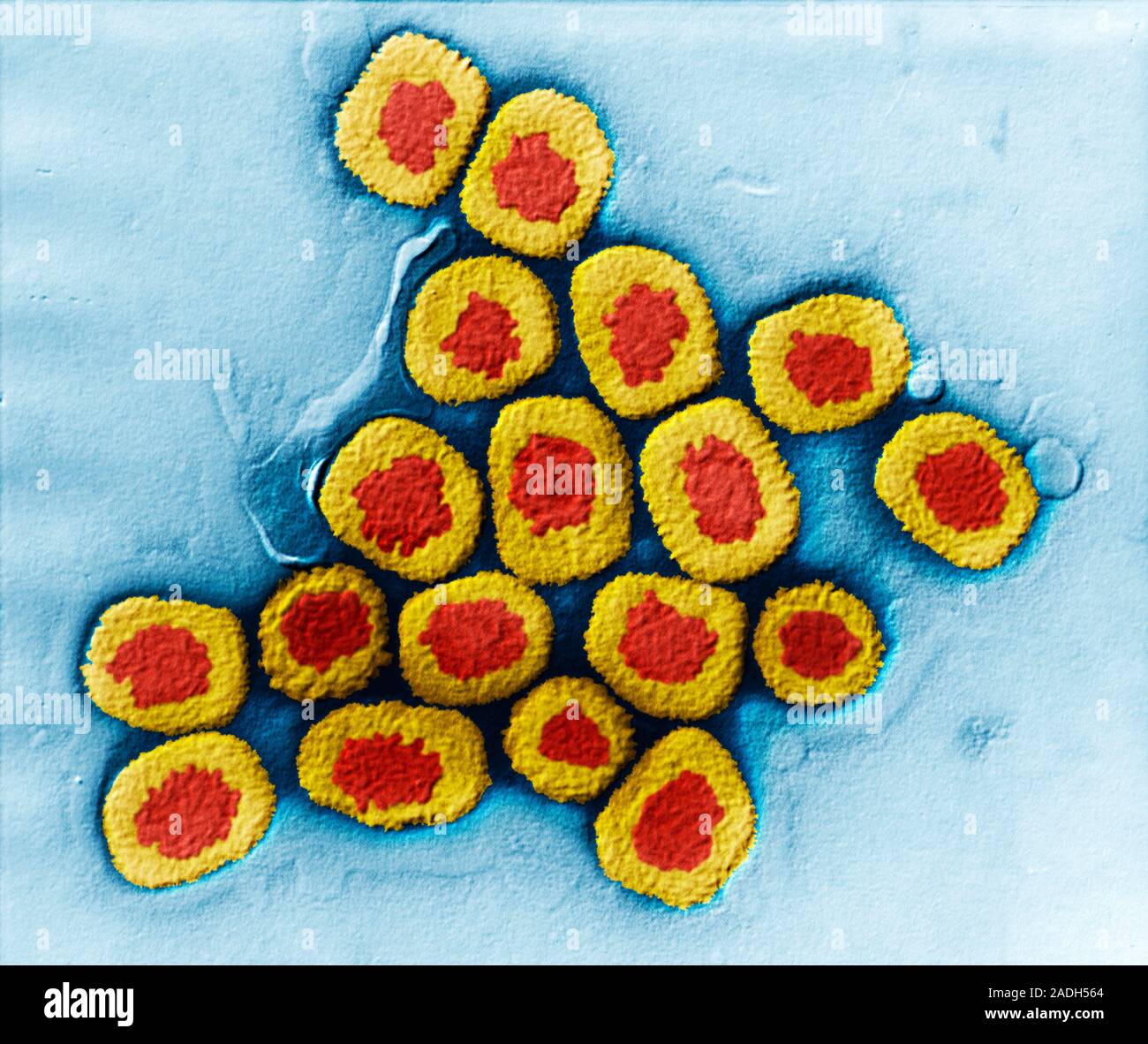 Smallpox viruses. Coloured transmission electron micrograph (TEM) of ...