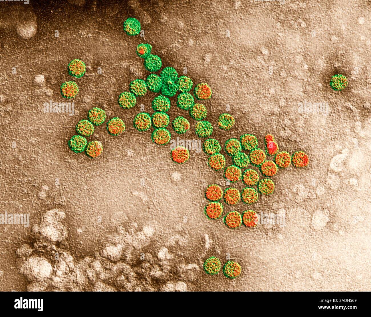 Polyoma viruses. Coloured transmission electron micrograph (TEM) of ...