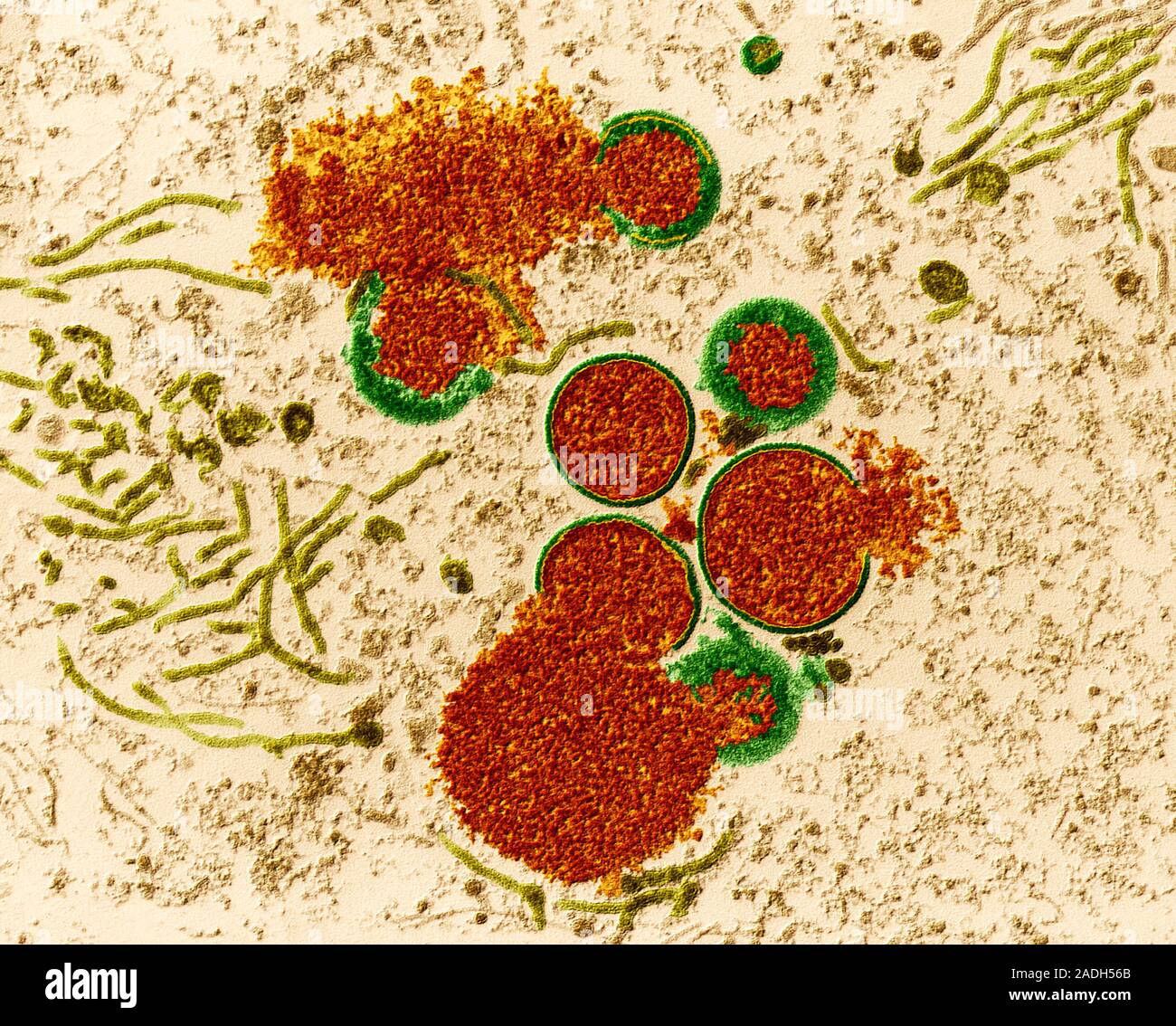Vaccinia virus particles. Coloured transmission electron micrograph ...