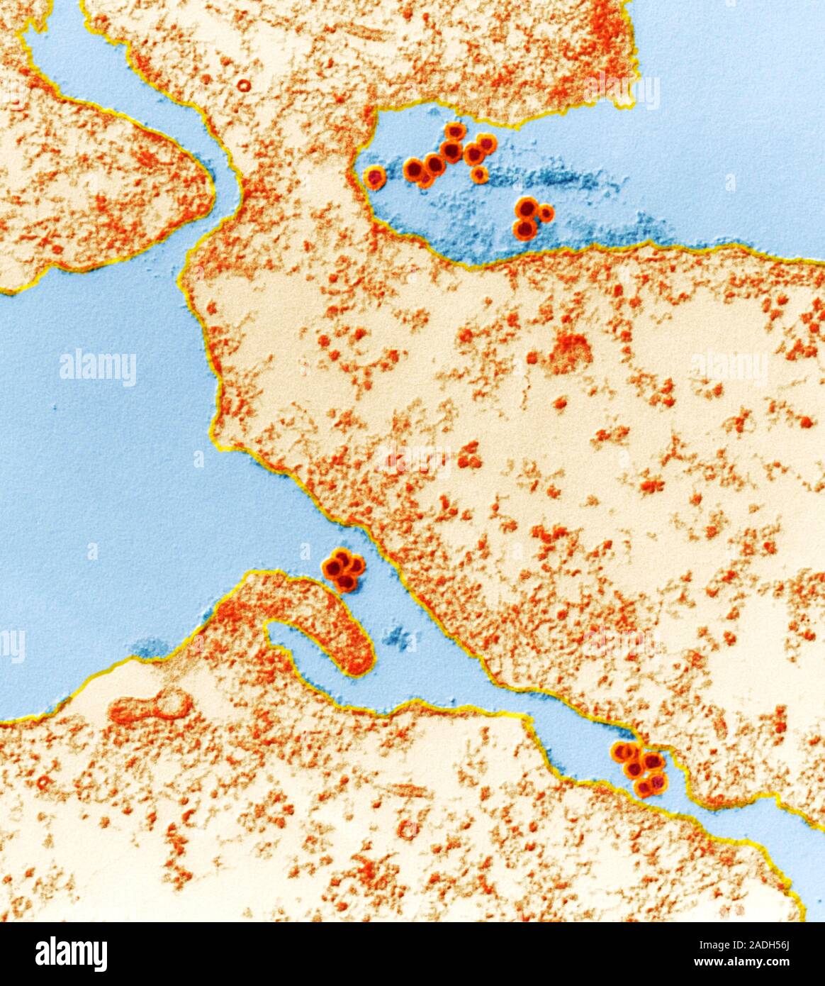 West Nile virus particles. Coloured transmission electron micrograph ...