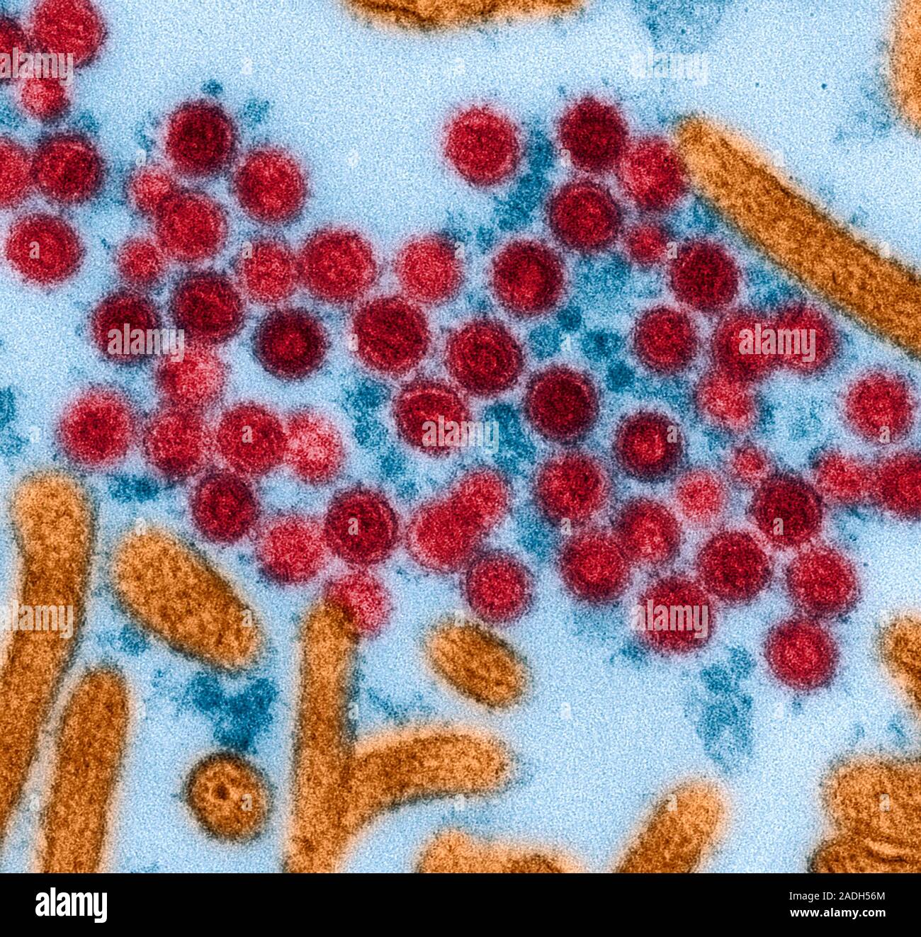 Mouse leukaemia viruses. Coloured transmission electron micrograph (TEM ...