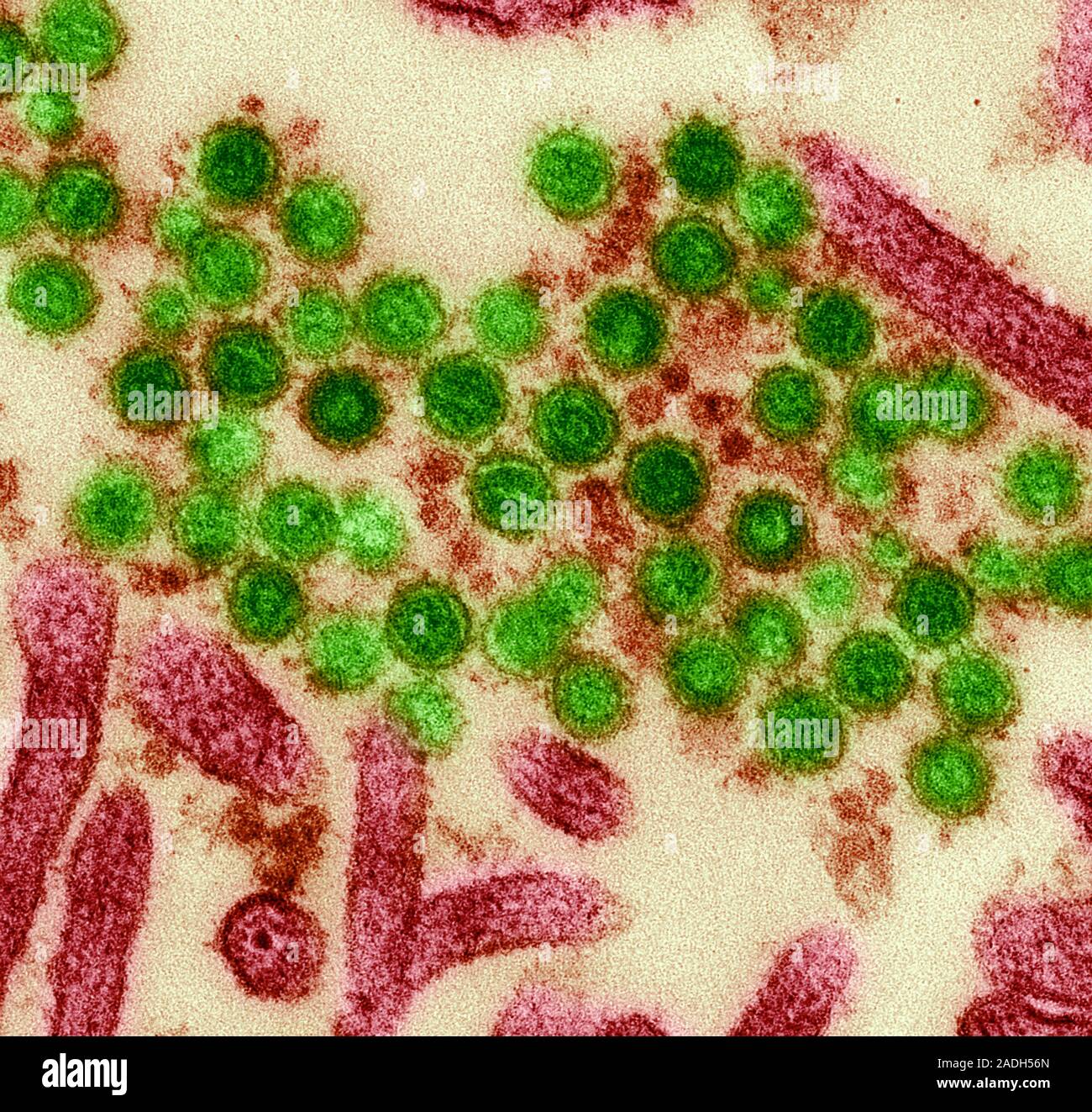 Mouse leukaemia viruses. Coloured transmission electron micrograph (TEM ...