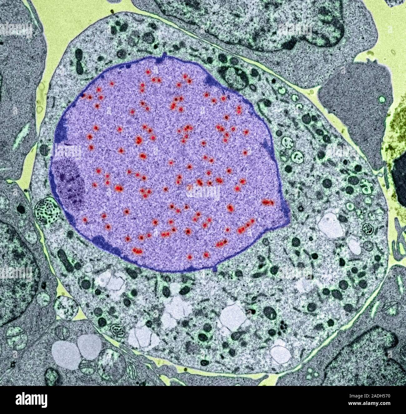 Epstein-Barr virus particles. Coloured transmission electron micrograph ...