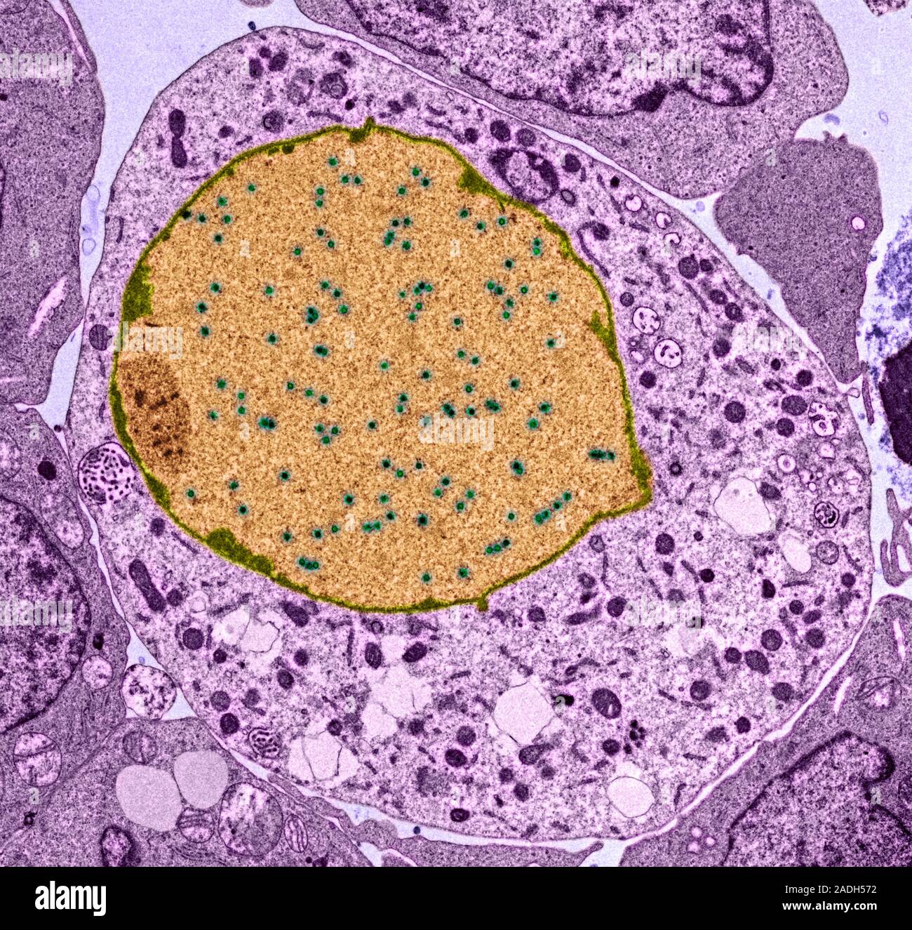 Epstein-Barr virus particles. Coloured transmission electron micrograph ...