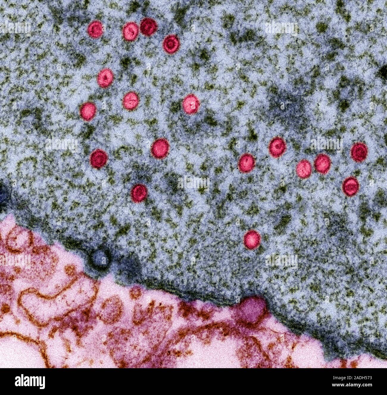 Epstein-Barr virus particles. Coloured transmission electron micrograph ...