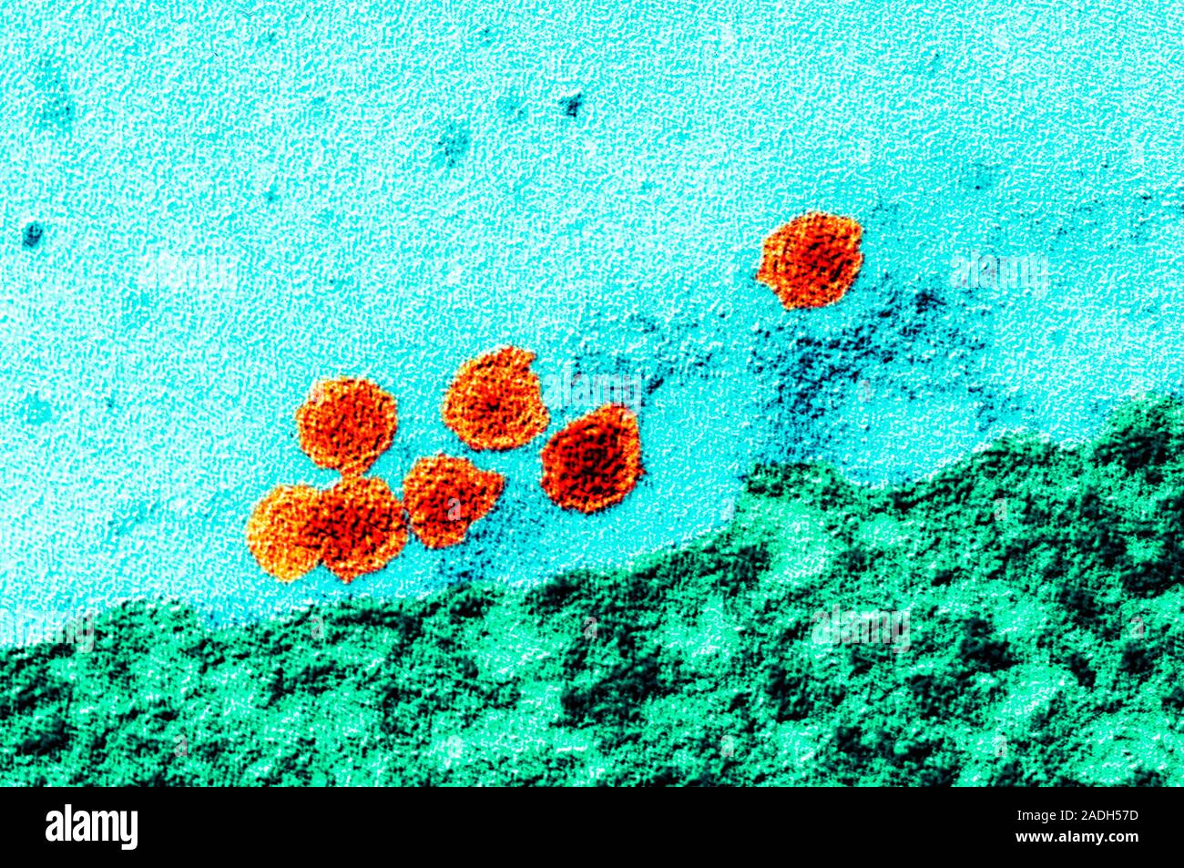 West Nile virus particles. Coloured transmission electron micrograph ...