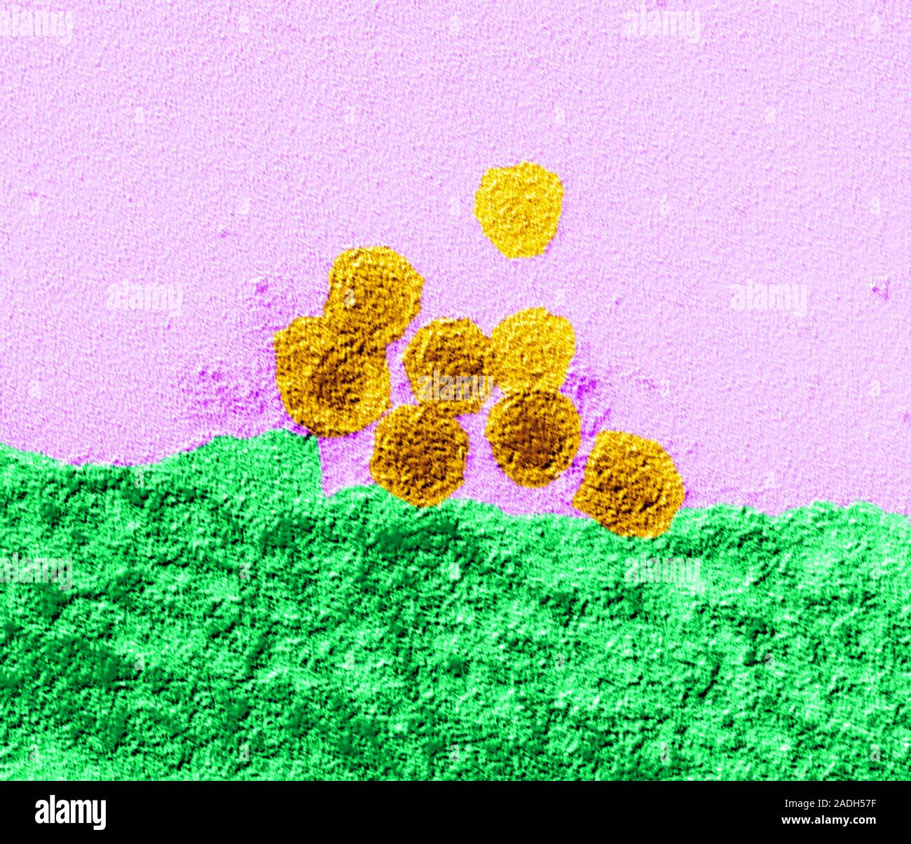 West Nile virus particles. Coloured transmission electron micrograph ...