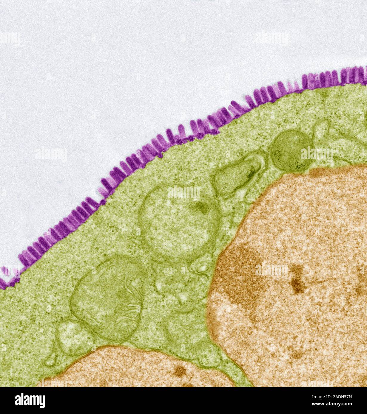 Vesicular stomatitis virus. Coloured transmission electron micrograph ...