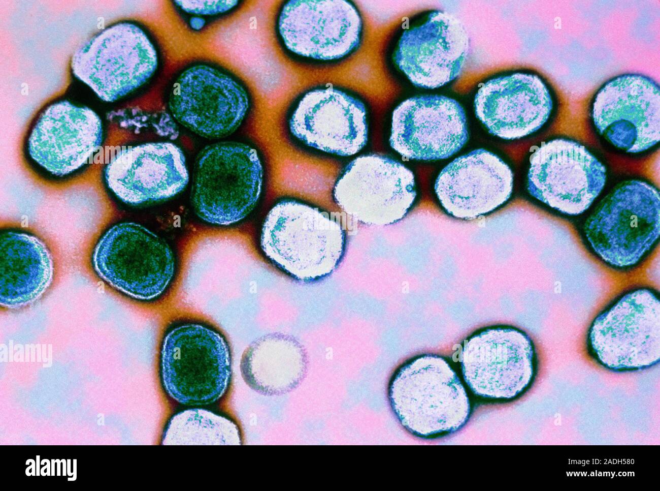 Vaccinia virus particles, coloured transmission electron micrograph ...