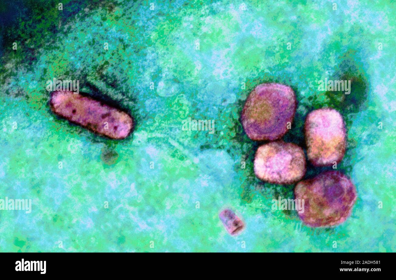 Smallpox virus particles. Coloured transmission electron micrograph (TEM) of variola virus ...
