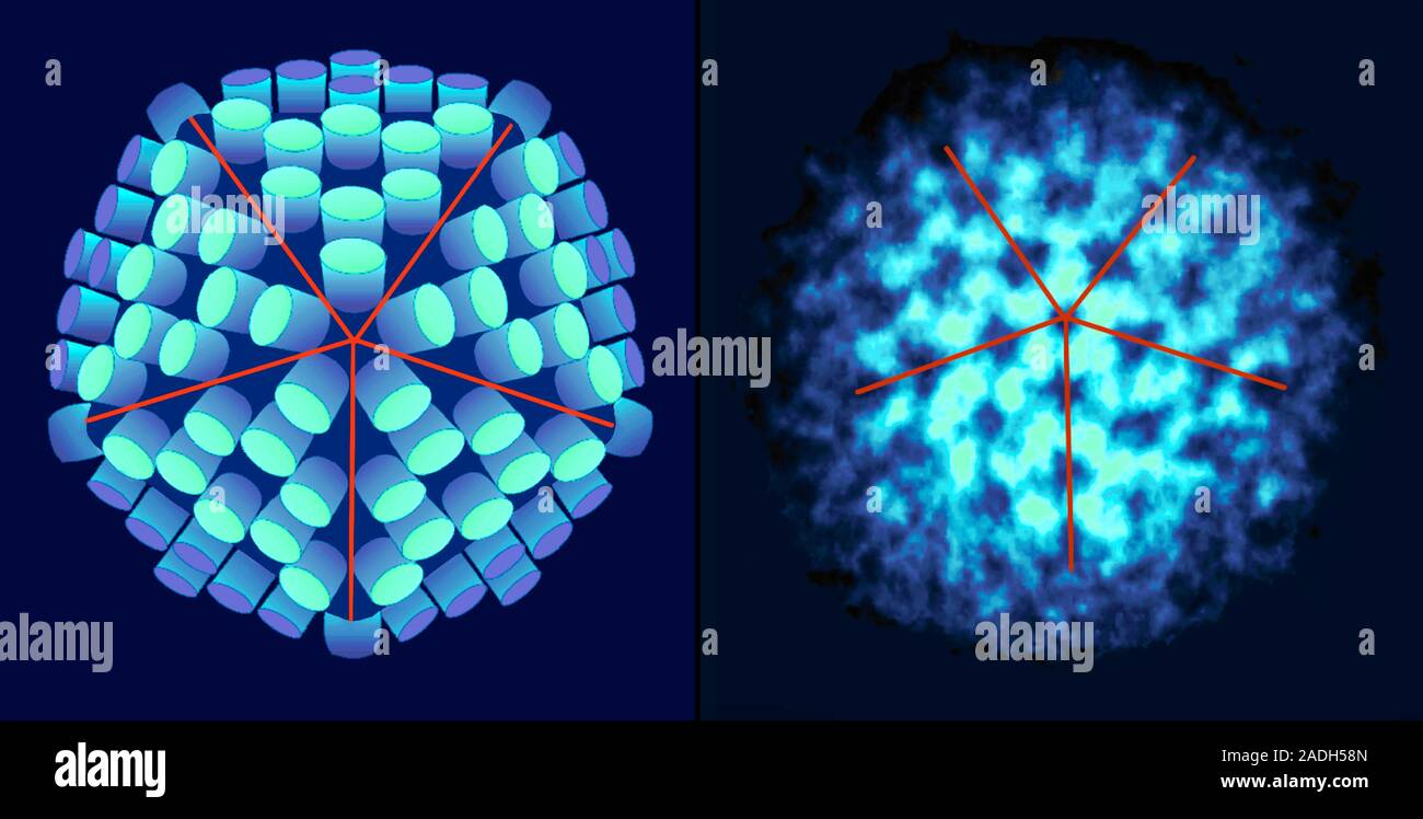 Rotavirus particle. Computer artwork (left) and coloured transmission ...
