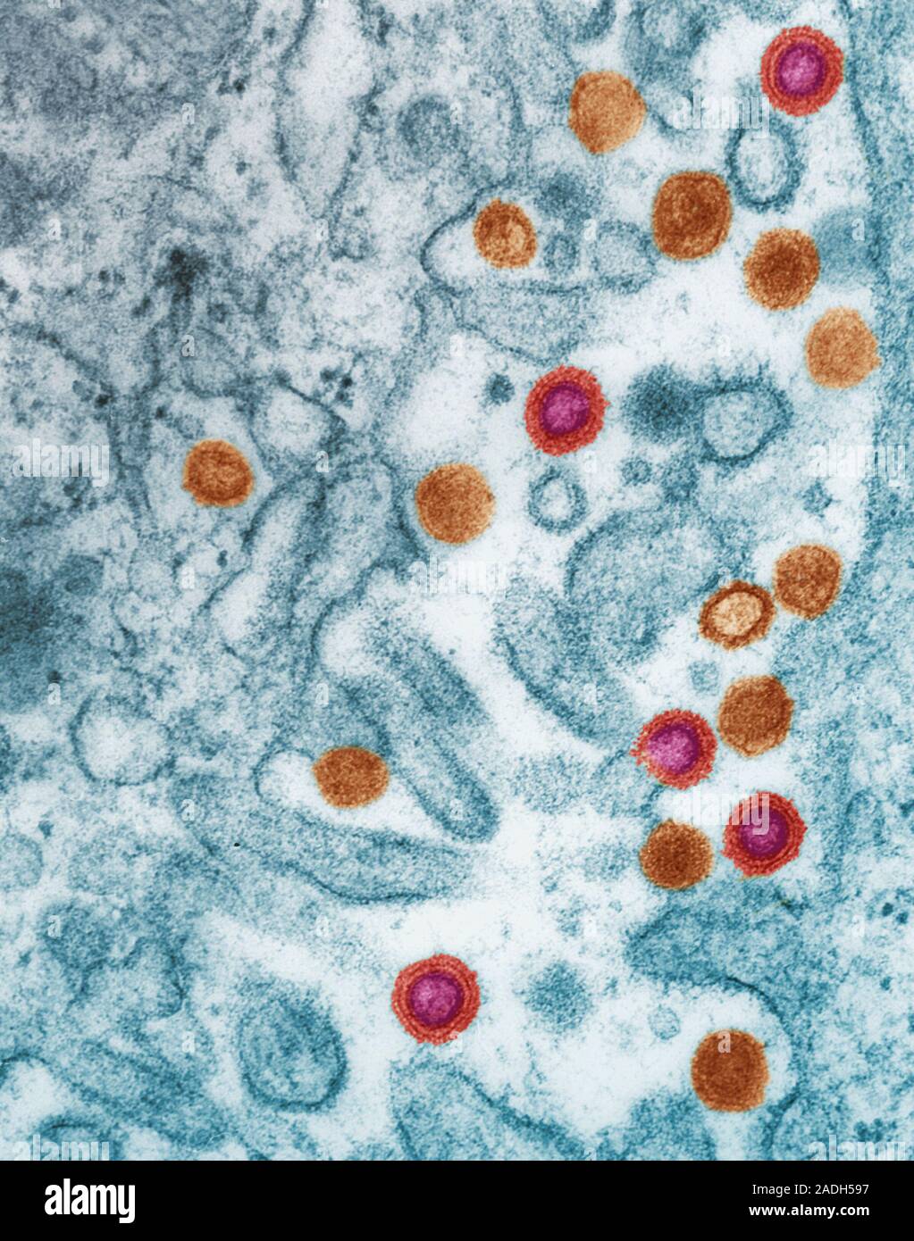 AIDS virus particles (red and orange) budding from the surface of a T4 ...